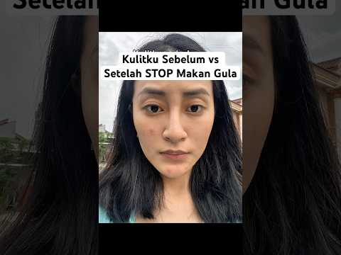 My Skin Before vs After STOPPING Sugar | dr. Clarin Hayes, MBiomed(AAM)