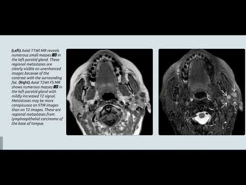 Head and neck radiology diagnostic imaging series images only(3)