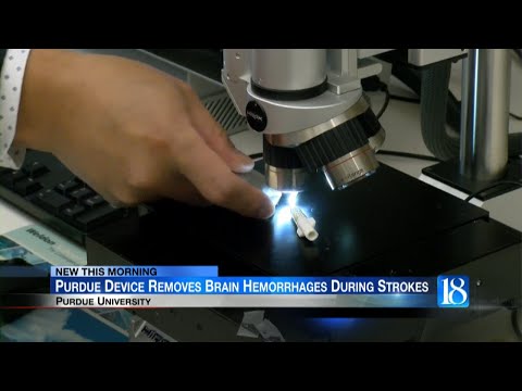 Purdue microdevice could be breakthrough for treating strokes