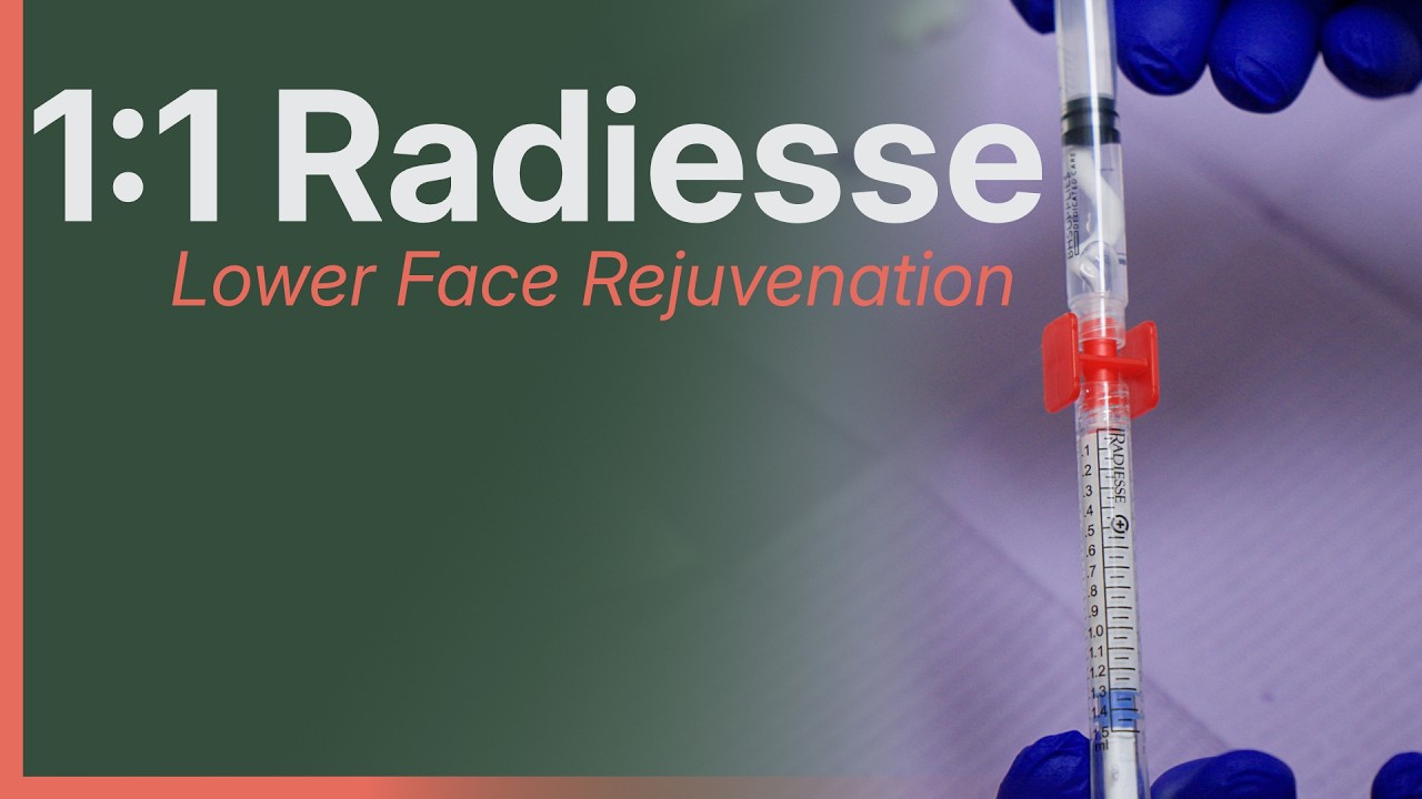 Step-by-Step Guide: Mixing Hyperdilute Radiesse | Part One