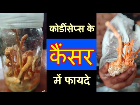 Scientific Benefits of Cordyceps Militaris in Cancer in Humans