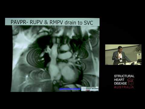 Interesting MRI Cases of the Right Heart - Dr Raj Puranik