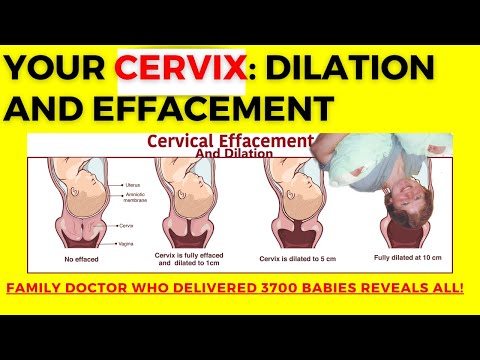 Cervical dilation and cervical effacement: everything you need to know about your cervical exam