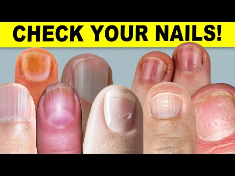 9 Things Your Nails Can Tell You About Your Health