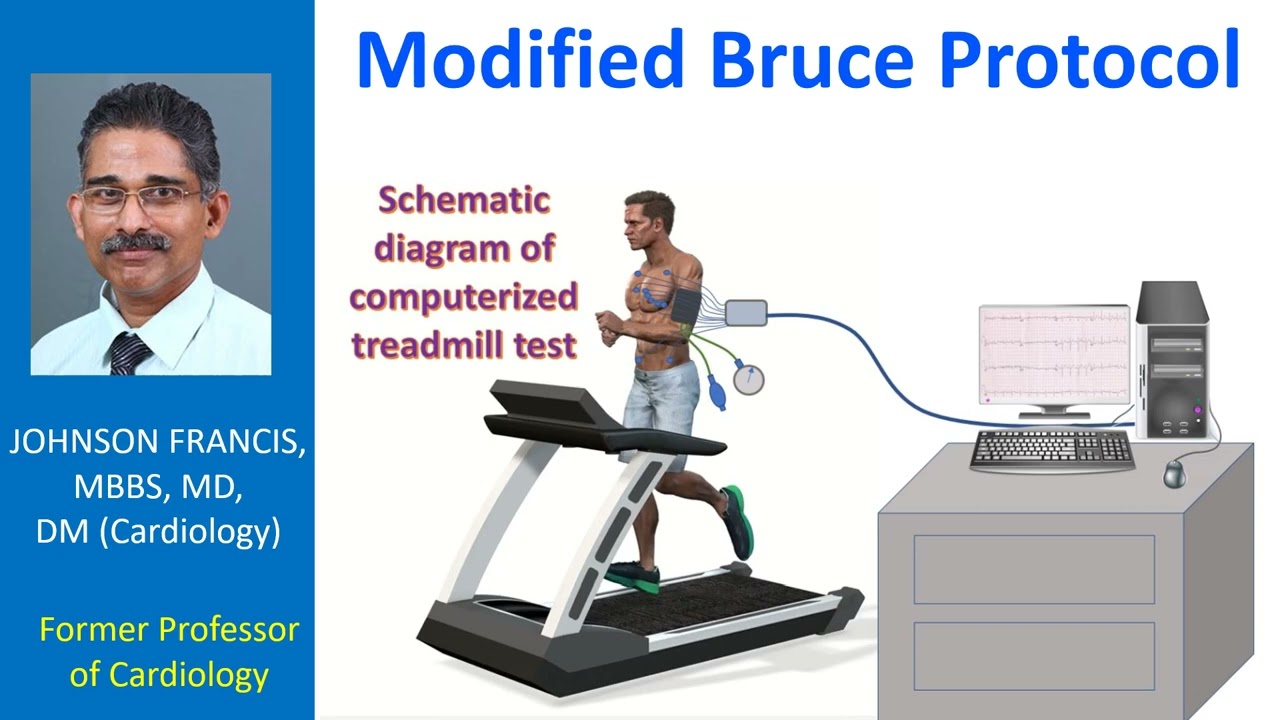 what-is-modified-bruce-protocol-en-general
