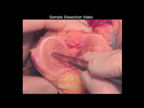 Stoller’s Orthopaedics and Sports Medicine: The Knee Lecture Video Sample