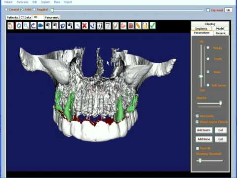 Solidplanner_(new_1).flv