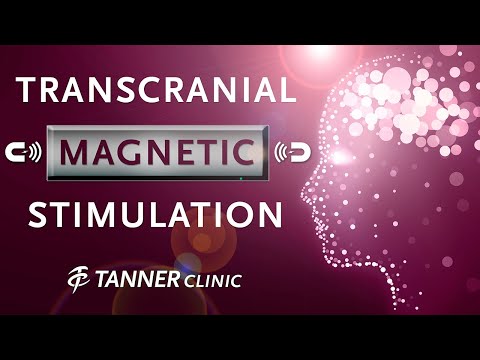 What is Transcranial Magnetic Stimulation TMS? Dr. Van Leeuwen from Tanner Clinic Answers