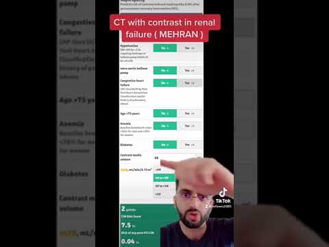 59 MEHRAN MD CALC