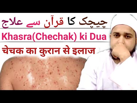 Khasra ki dua | chechak ka wazifa || chechak ki dua | chechak ka ilaj | Mufti Tabrez Qasmi