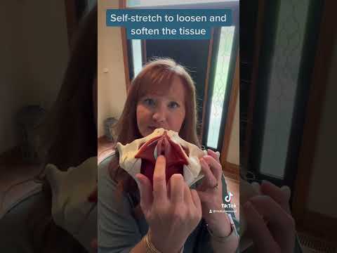 Treatment for a painful perineal scar after a vaginal delivery from a tear/episiotomy.