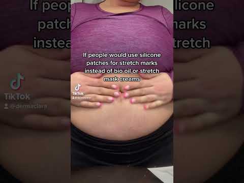 Silicone patches for stretch marks