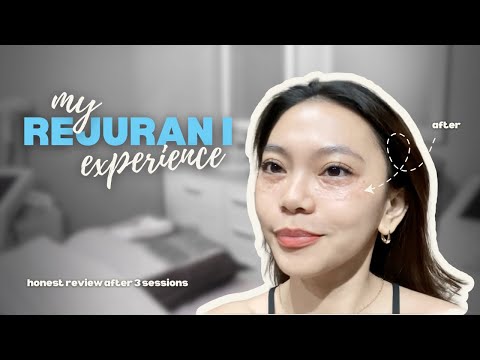 Does Rejuran I Treatment REALLY Fix Tired Eye Bags?