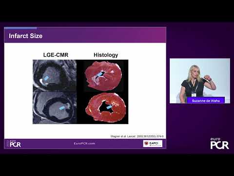Is PCI enough in STEMI? - EuroPCR 2022