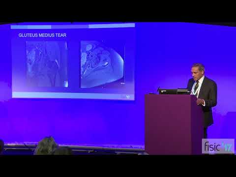 Posterior hip pain