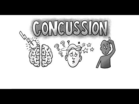 What is a concussion?