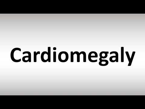 How to Pronounce Cardiomegaly