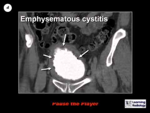 LearningRadiology 17 (10 Imaging Cases)