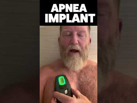 ⚡️Inspire Sleep Apnea Implant Activation By Doug #shorts⚡️