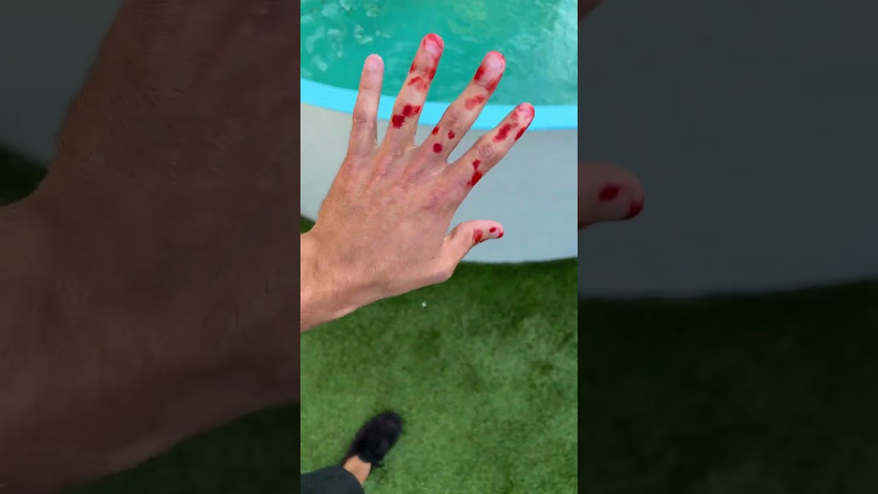 WHEN JAWS Attack you p.2