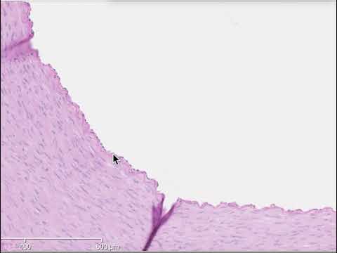simple squamous epithelium