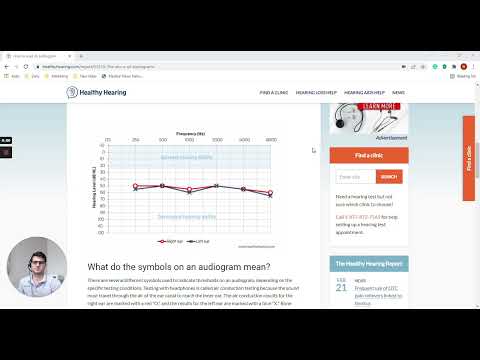 What is an Audiogram?