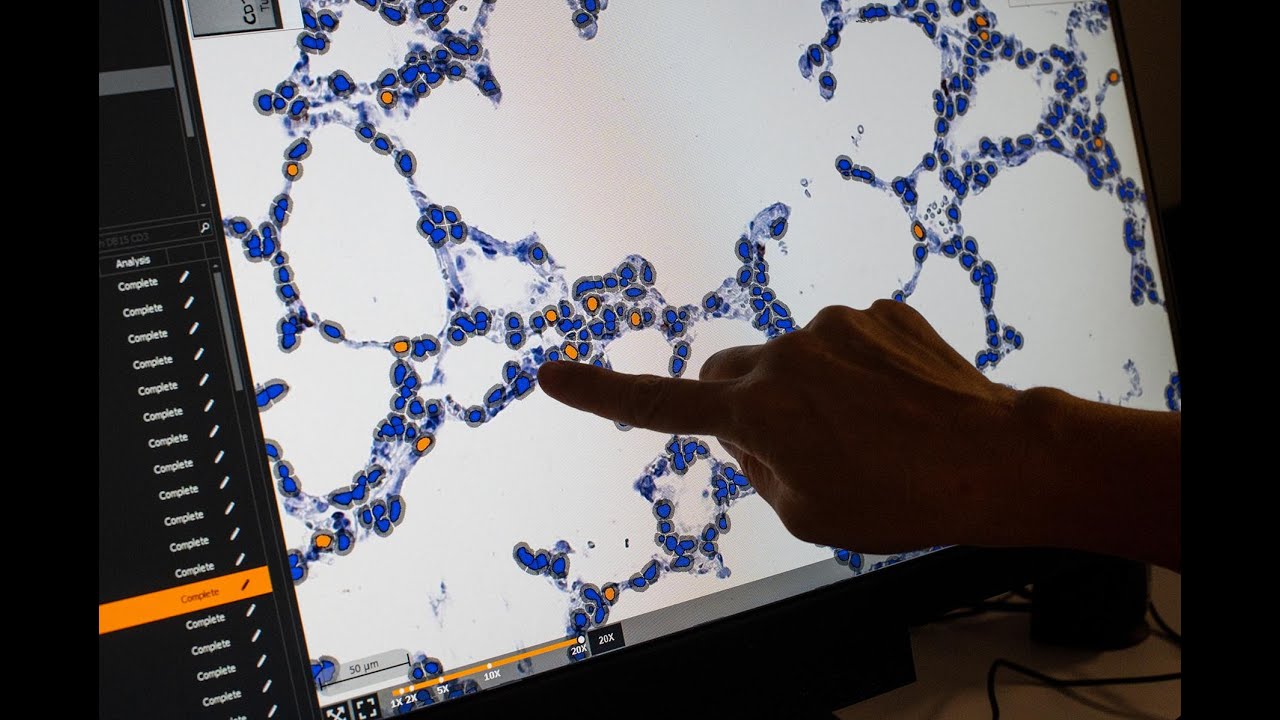 Teaching Pathology—Digitally