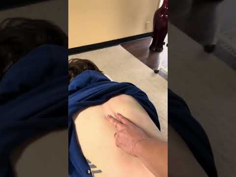 San Diego's best scoliosis chiropractor