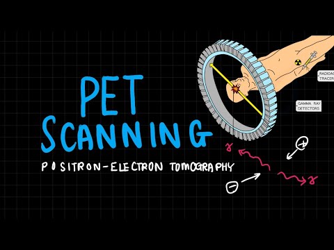 Positron-Electron Tomography (PET Scan) | Medical Physics | A Levels | New Syllabus