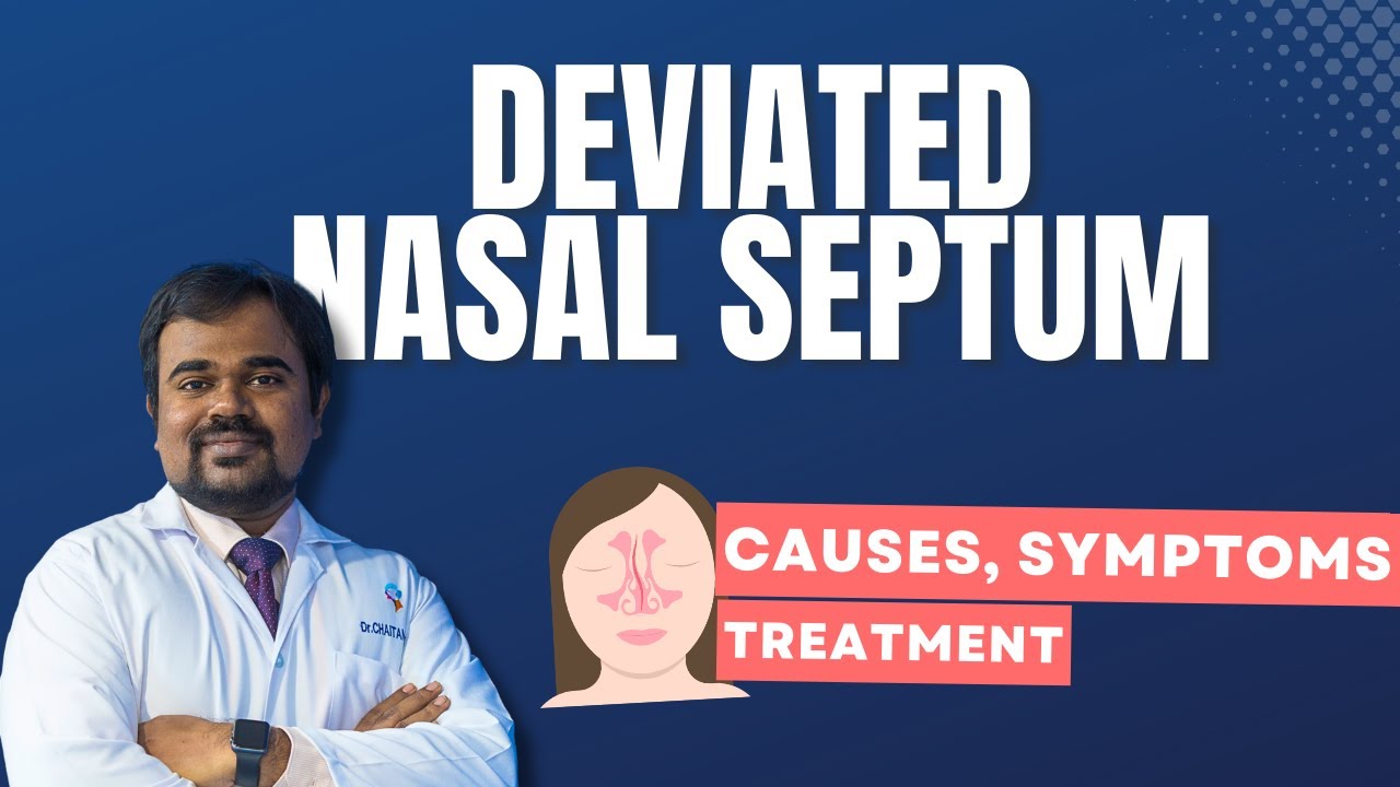 Deviated Nasal Septum | DNS Causes,Symptoms & Treatment #DNS
