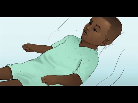 Mgmt of Pediatric Status Epilepticus in Resource-Limited Settings by L.Hayes et al. | OPENPediatrics