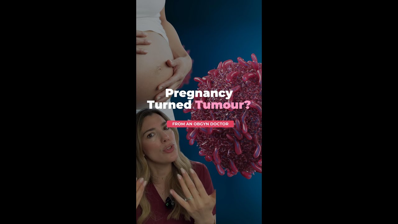 What is a molar pregnancy?