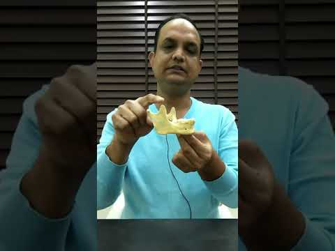 MANDIBLE: Bony Features