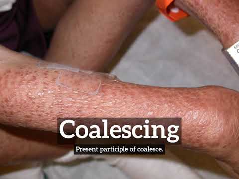 What is Coalescing? | How to Say Coalescing in English? | How Does Coalescing Look?