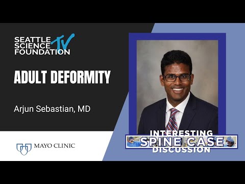 Adult Deformity - Arjun Sebastian, MD