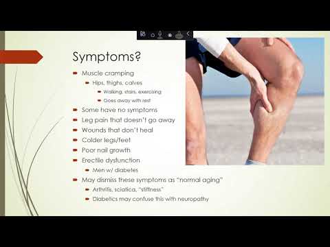Dr. George Mueller, Virginia Cardiovascular Specialists discusses Peripheral Arterial Disease (PAD)