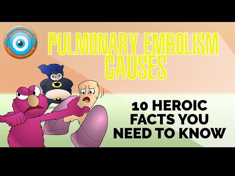 10 Heroic Facts About Pulmonary Embolism Causes (Step 1, COMLEX, NCLEX®, PANCE, AANP)