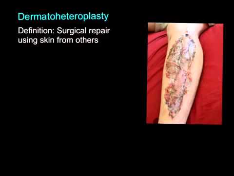 Integ system surgical terms built from word parts II