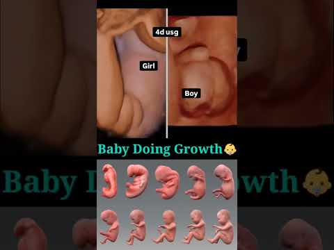 4D ultrasound scan of pregnant women