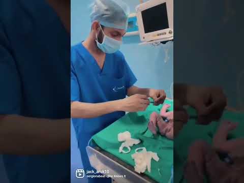 lscs ... baby girl 2.8 kg Kingston hospital 🏥 ... plz subscribe and like 🙏
