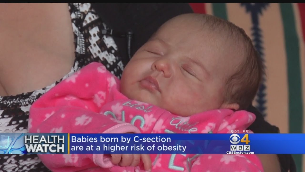 HealthWatch: C-Section Obesity Risk, Baby Talk Same Around World