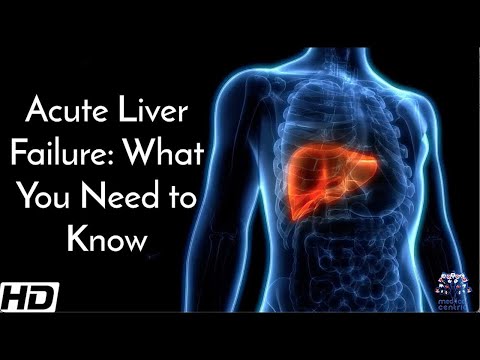Acute Liver Failure: What You Need To Know