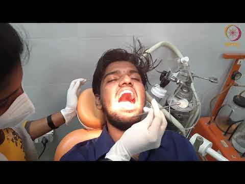 POSTURAL HYPOTENSION - CLINICAL SCENARIO
