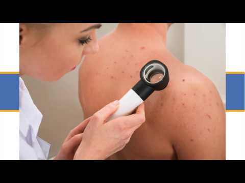 Acne in Children