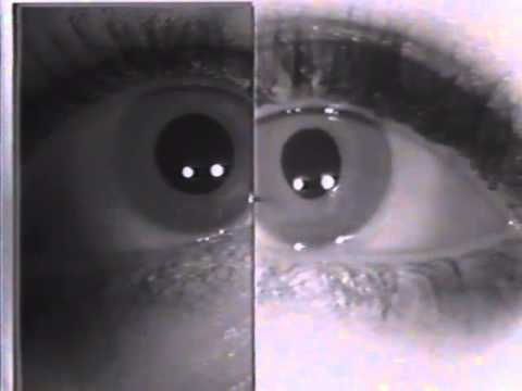 Dilation Lag