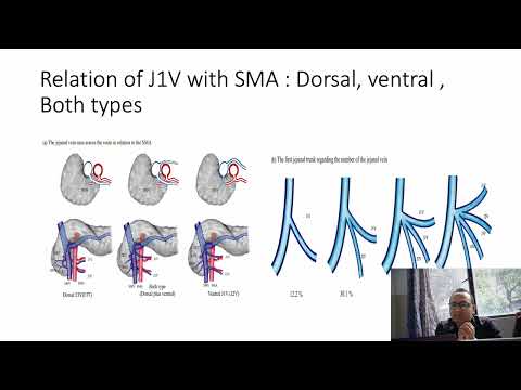 Vascular Challenges in pancreatic surgery