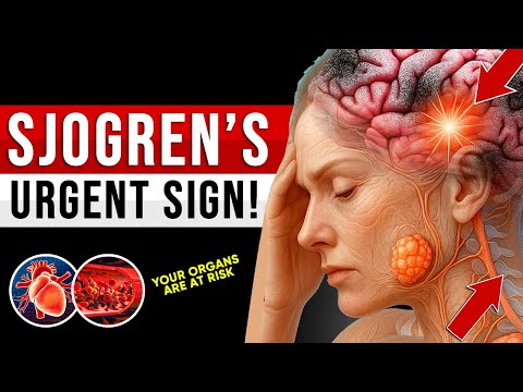 URGENT: Sjögren’s Symptoms You CANNOT Ignore, 10 Organs Under Attack (This Could Save Your Life!)