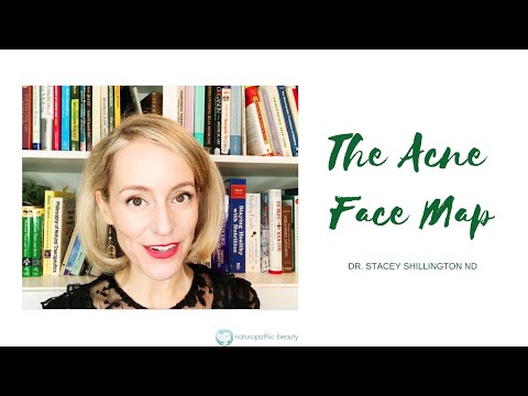 The Acne Face Map