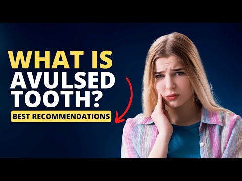 What is Avulsed Tooth? - Best Recommendations when a tooth is avulsed