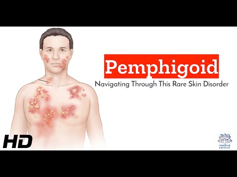 Pemphigoid 101: A Deep Dive into Symptoms, Treatment, and Care